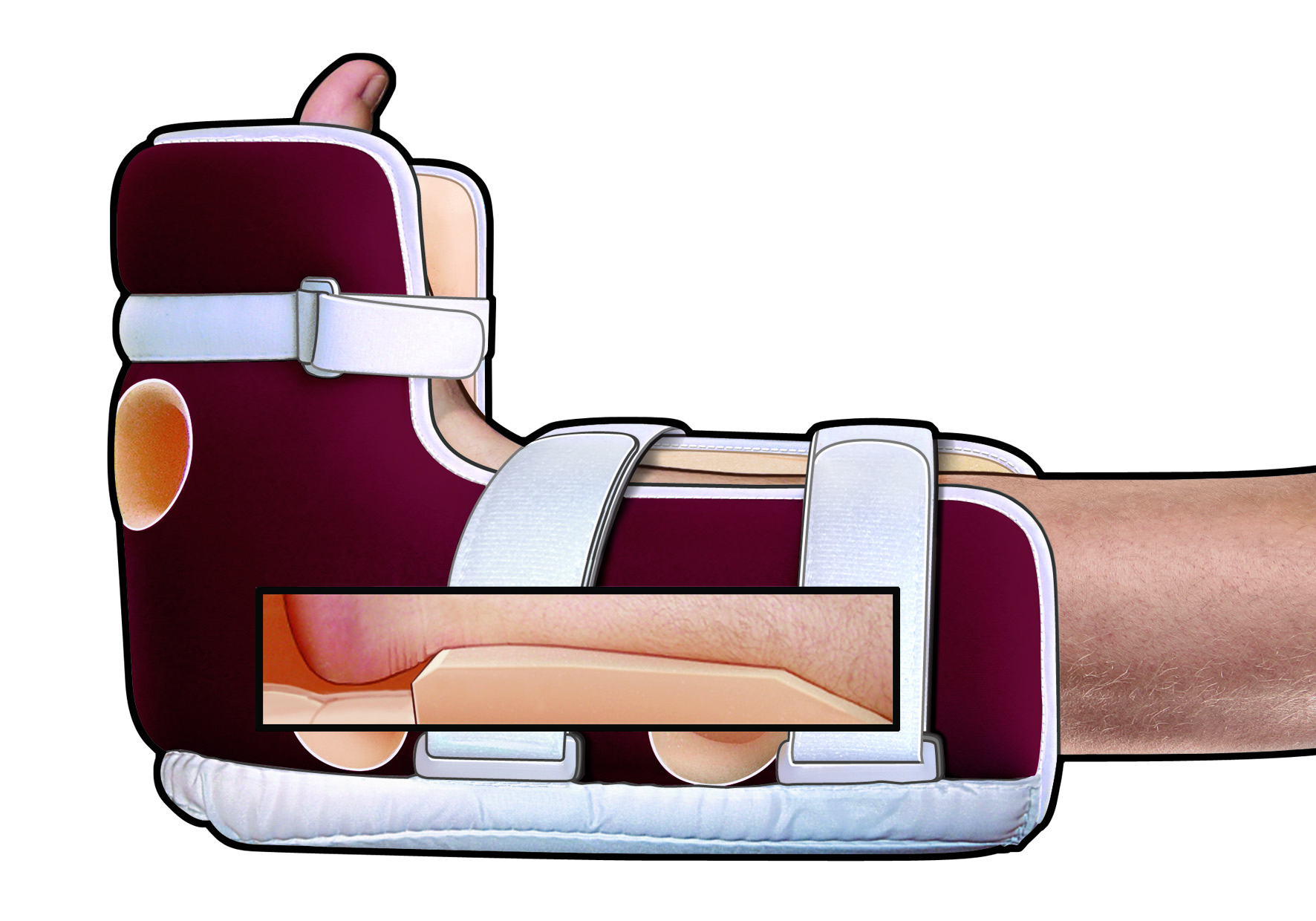 ICONIC - Heelift Glide